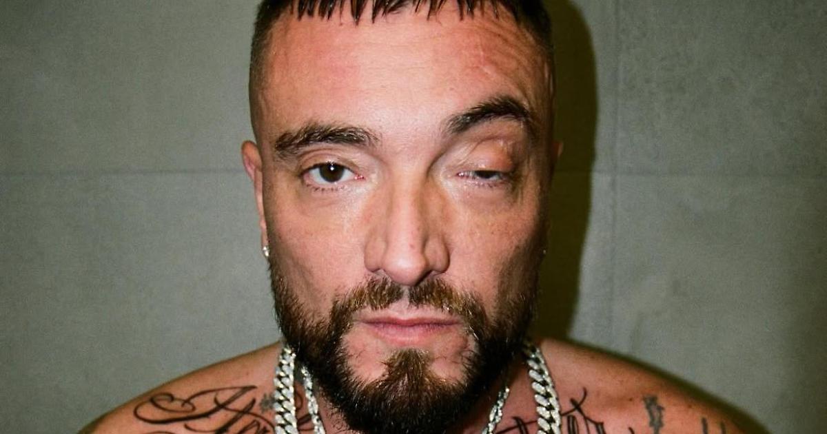 Guè, chi è il rapper ospite a Belve: le origini del nome e la malattia ...